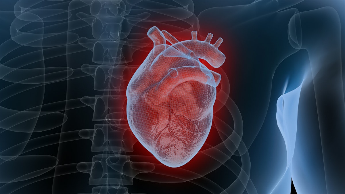Florida, Vermont Pass Laws Aimed at Cardiac Safety for HS Athletes ...